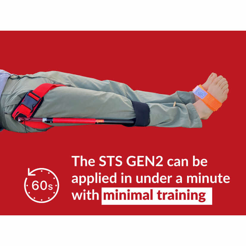 Slishman Traction Splint (STS), Gen 2 | Bound Tree